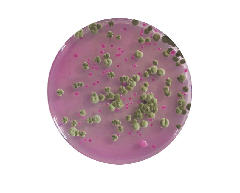 Symphony Agar | Atropos